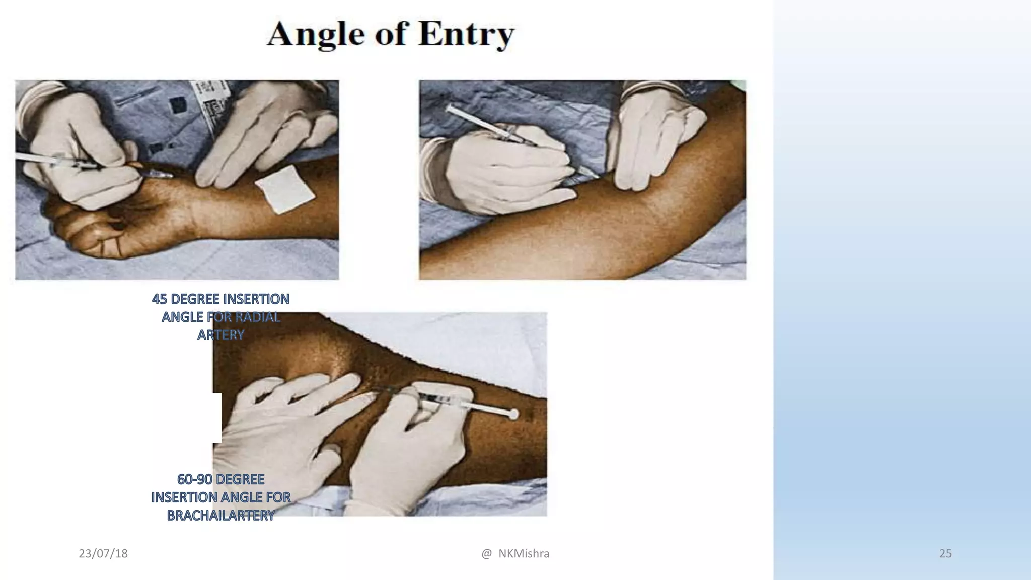 Approach to ABG Analysis | PPTX