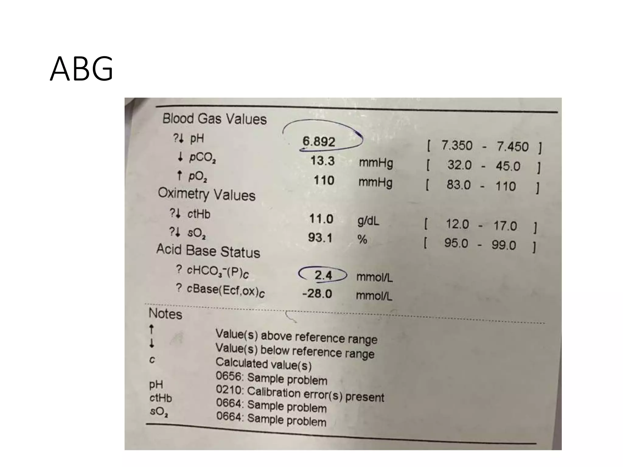 abg interpretation.pptx