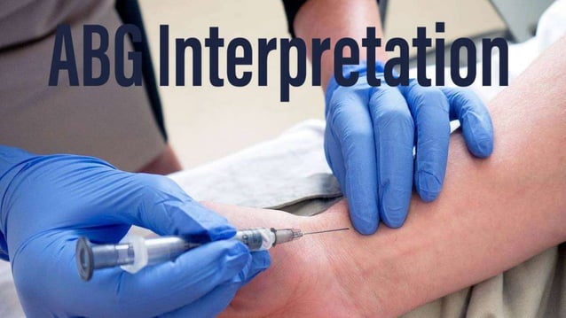 ABG interpretation | PPTX