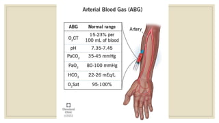 ABG micro teaching.pptx