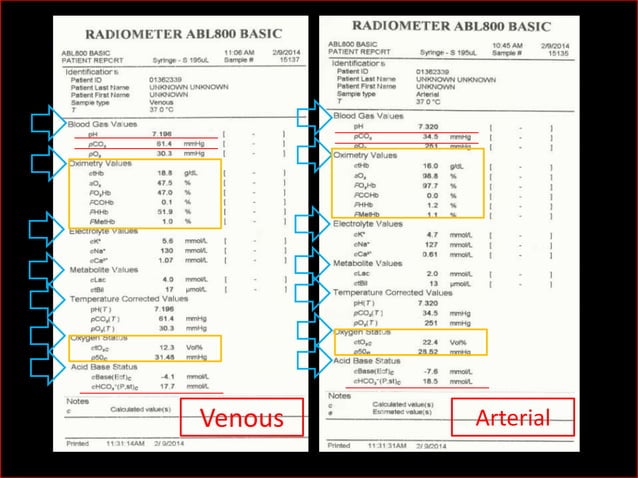 Interpreting Blood Gases, Practical and easy approach | PPSX