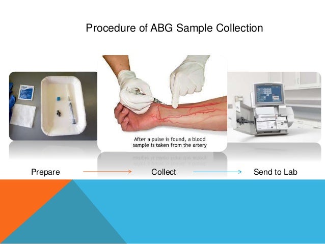 ABG slidshare
