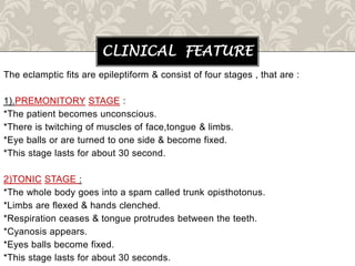 Eclampsia ppt | PPTX
