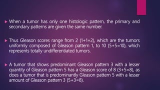 GLEASON SCORING | PPT