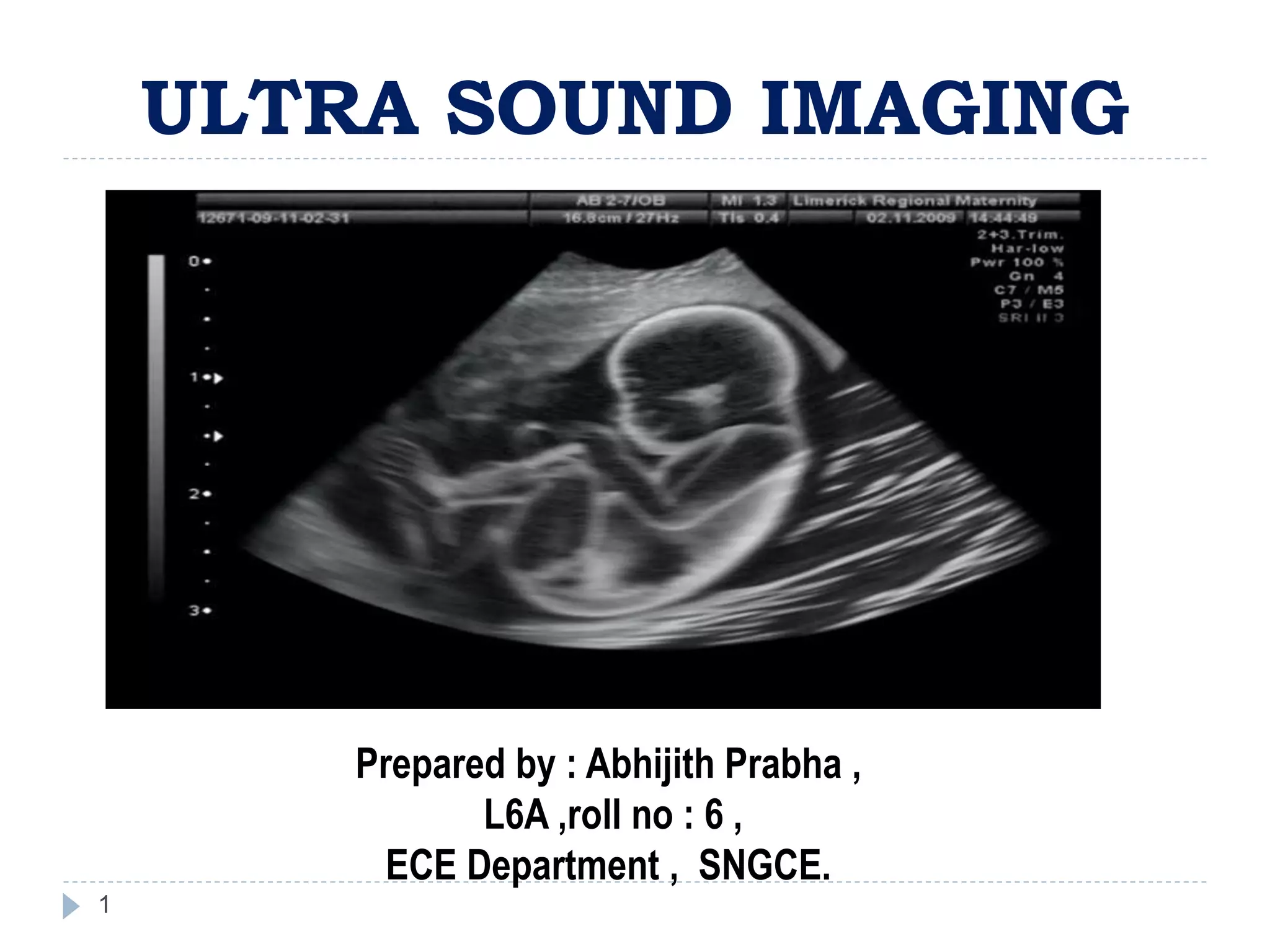 Ultra Sound Imaging | PPTX