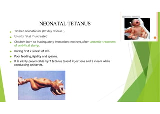 TETANUS Department of Physiotherapy, SHUATS, Prayagraj | PPTX