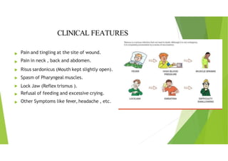 TETANUS Department of Physiotherapy, SHUATS, Prayagraj | PPTX