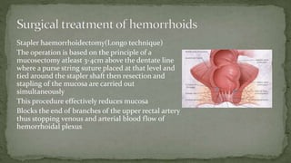 Surgery of haemoroida | PPT