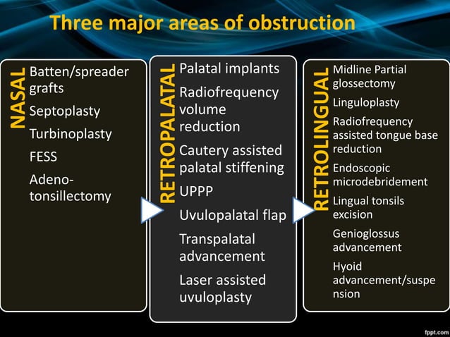 surgical management of OSA | PPTX | Ear, Nose and Throat Conditions ...