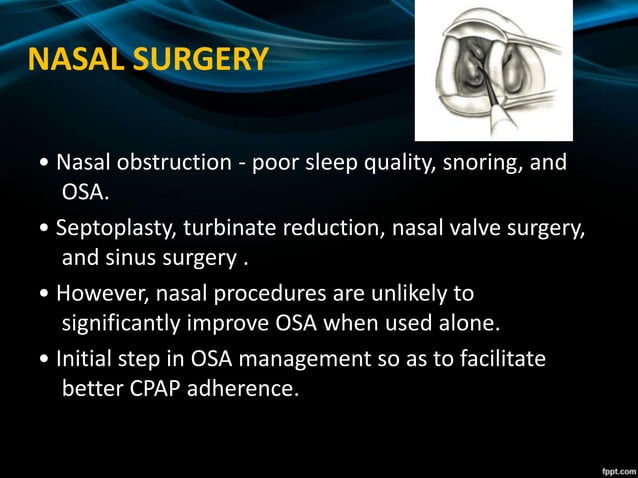 surgical management of OSA | PPTX | Ear, Nose and Throat Conditions ...