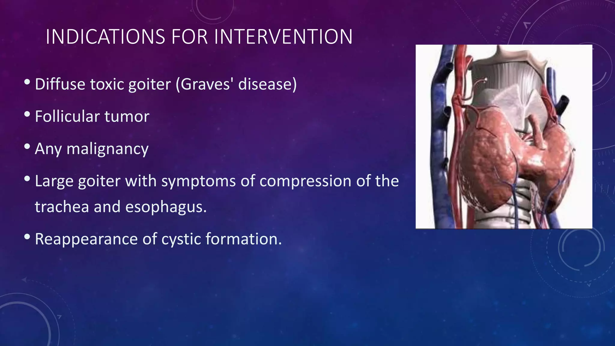 Operation in thyroid | PPT