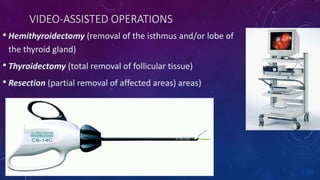 Operation in thyroid | PPTX