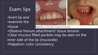 general and oral examination | PPTX