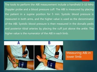 ROLE OF ANKLE BRACHIAL INDEX TO PREDICT PERIPHERAL ARTERIAL DISEASE, A ...