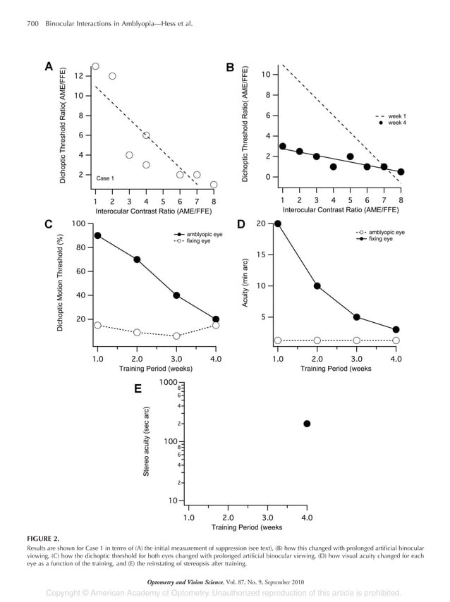 A binocular approach_to_treating_amblyopia_.11