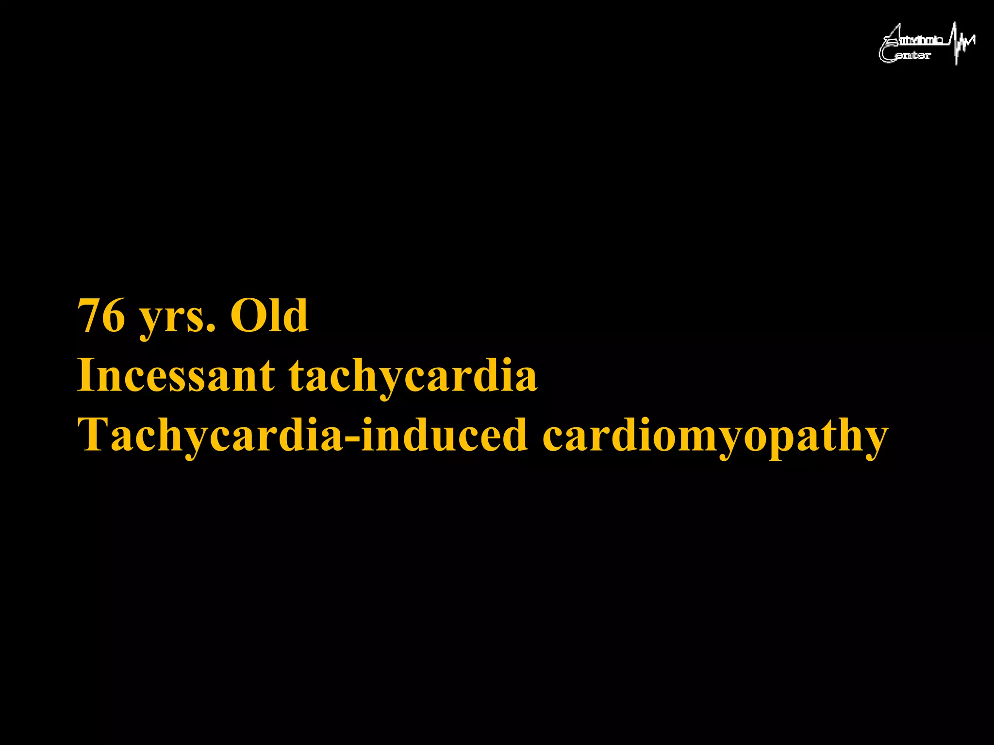 Ablation of atypical flutter | PPTX