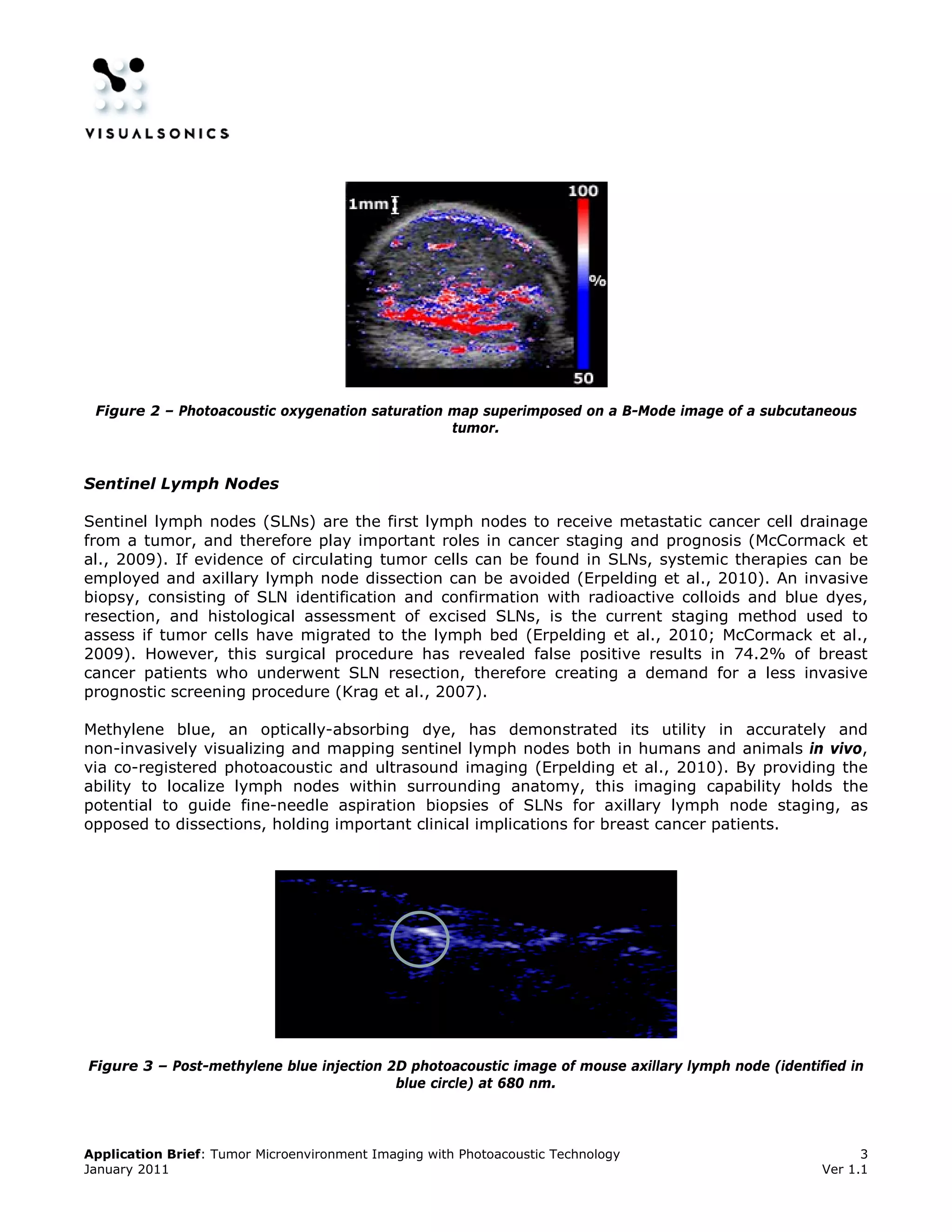 Application Brief: Tumor Microenvironment Imaging with Photoacoustic ...