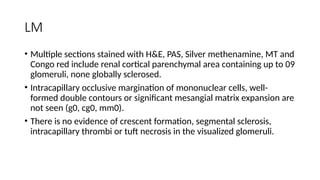 ABMR renal transplant complicationssssss | PPTX