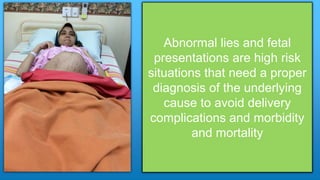 Abnormal lie & presentations; basic concepts | PPTX