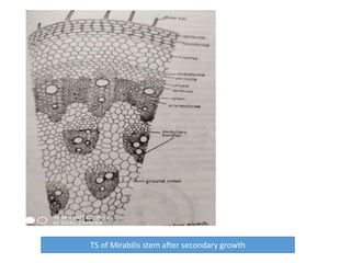 Abnormal secondary growth in dicot stem | PPTX