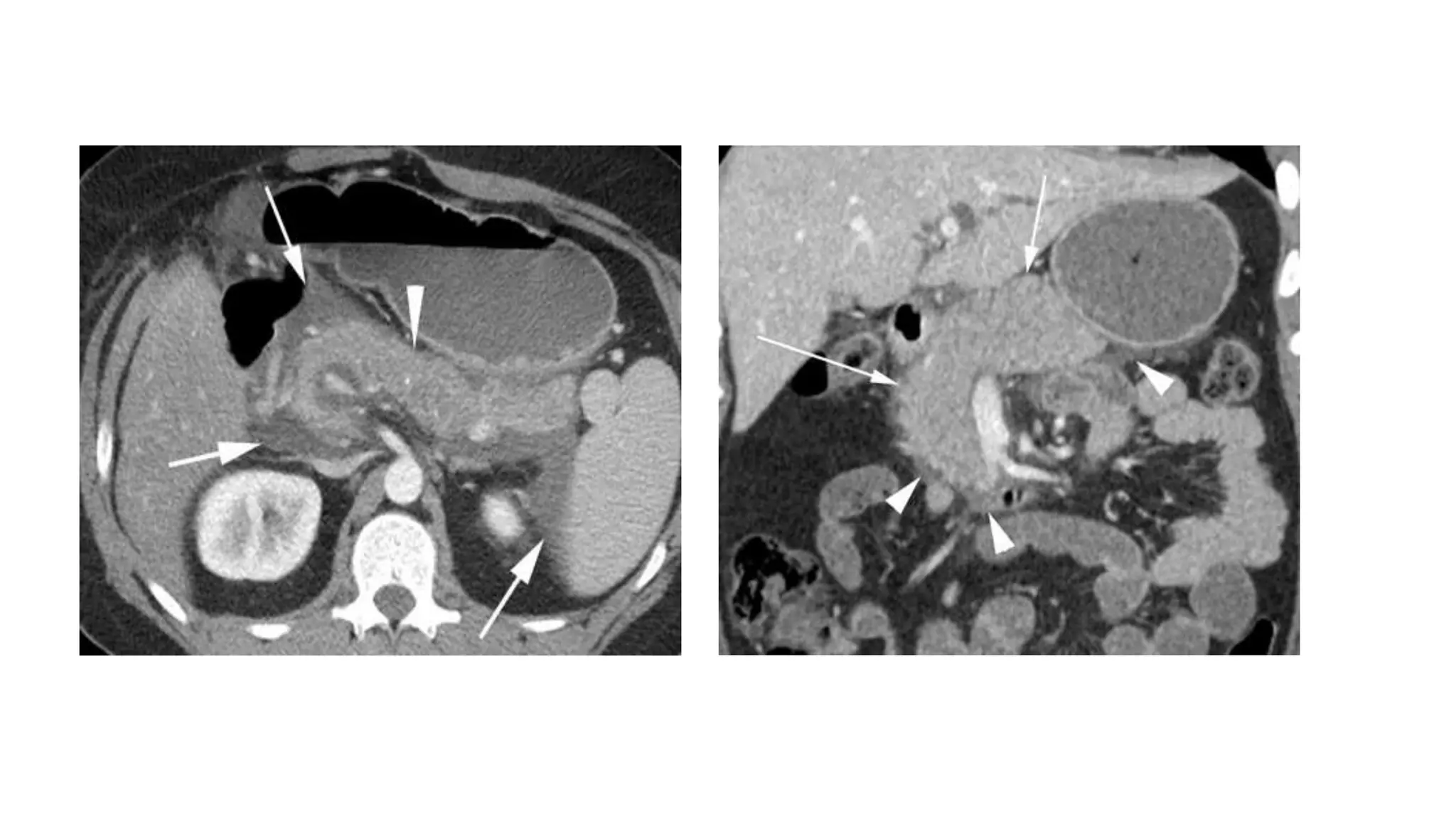 Abnormal abdominal ct ppt slide | PPTX