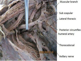 Abnormal branching pattern of the axillary artery | PPTX