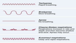 abnormalbreathingpattern-200904070539.pptx