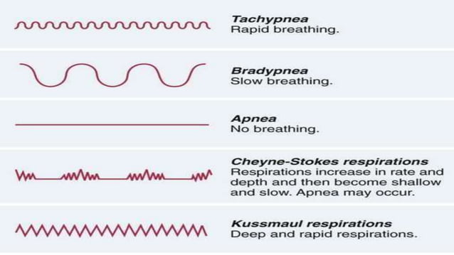 abnormalbreathingpattern-200904070539.pptx