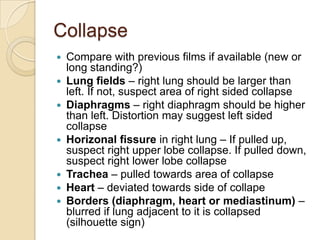 Abnormal chest radiograph part 1 | PPTX