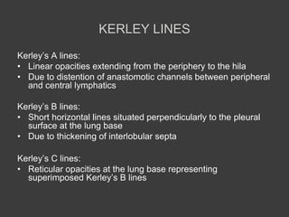 Abnormal Chest X rays | PPTX