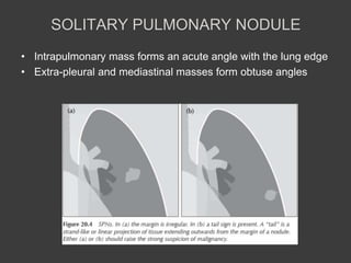 Abnormal Chest X rays | PPTX