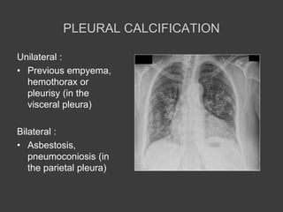 Abnormal Chest X rays | PPTX