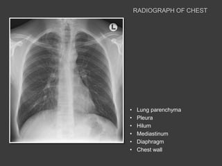 Abnormal Hilum Of Lung