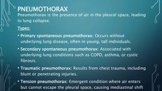 ABNORMAL CHEST XRAY in Icu care technology.pptx