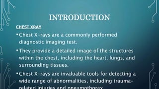 ABNORMAL CHEST XRAY in Icu care technology.pptx