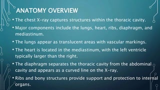 ABNORMAL CHEST XRAY in Icu care technology.pptx