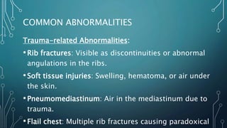 ABNORMAL CHEST XRAY in Icu care technology.pptx