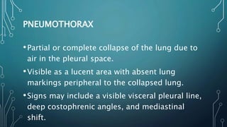 ABNORMAL CHEST XRAY in Icu care technology.pptx