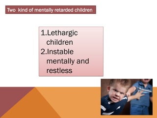 Abnormal children | PPT