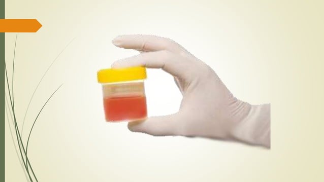 Abnormal constituents of human urine | PPTX