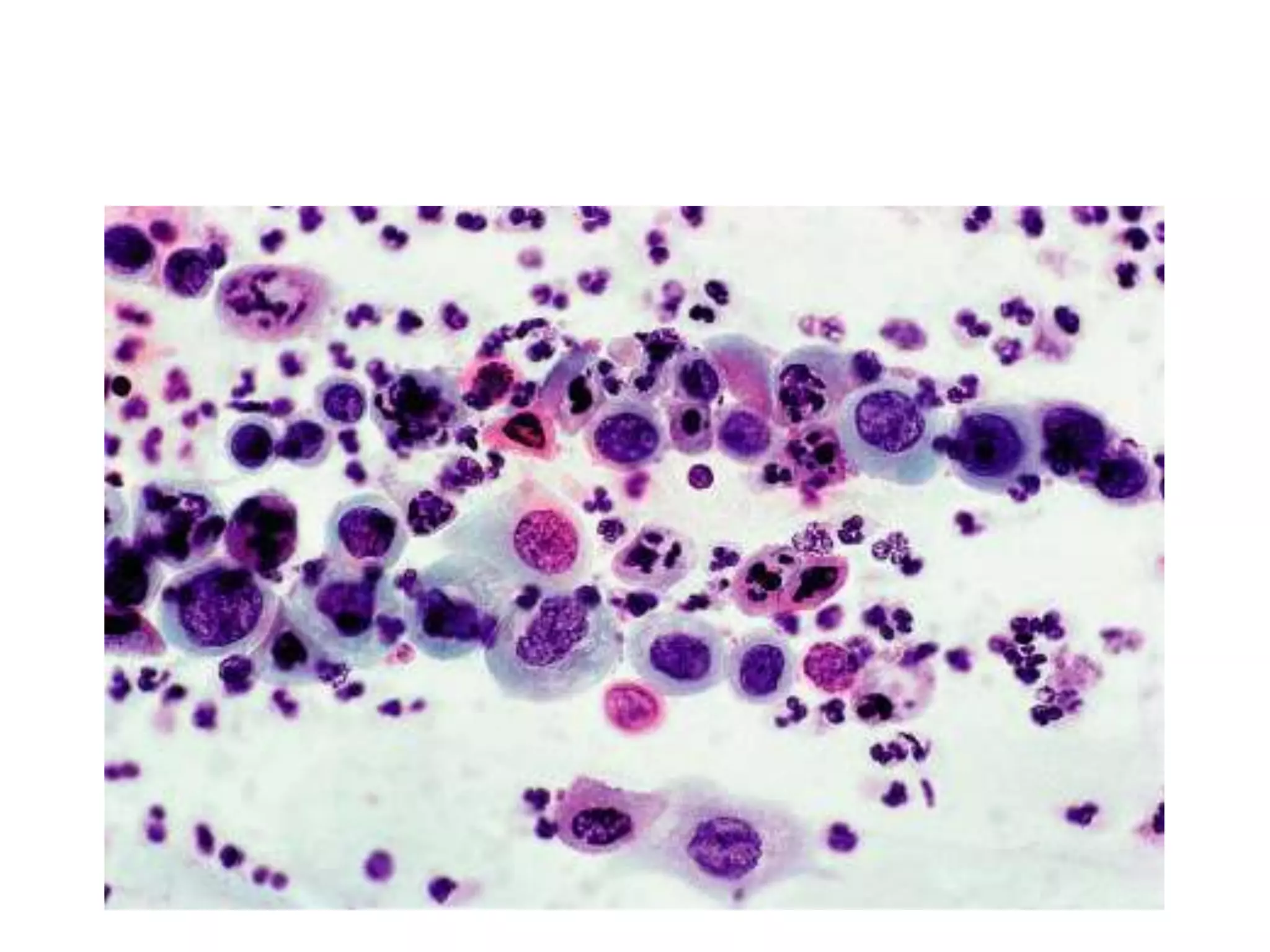 Abnormal cytology & histology of cervix _ Histopathology | PPT