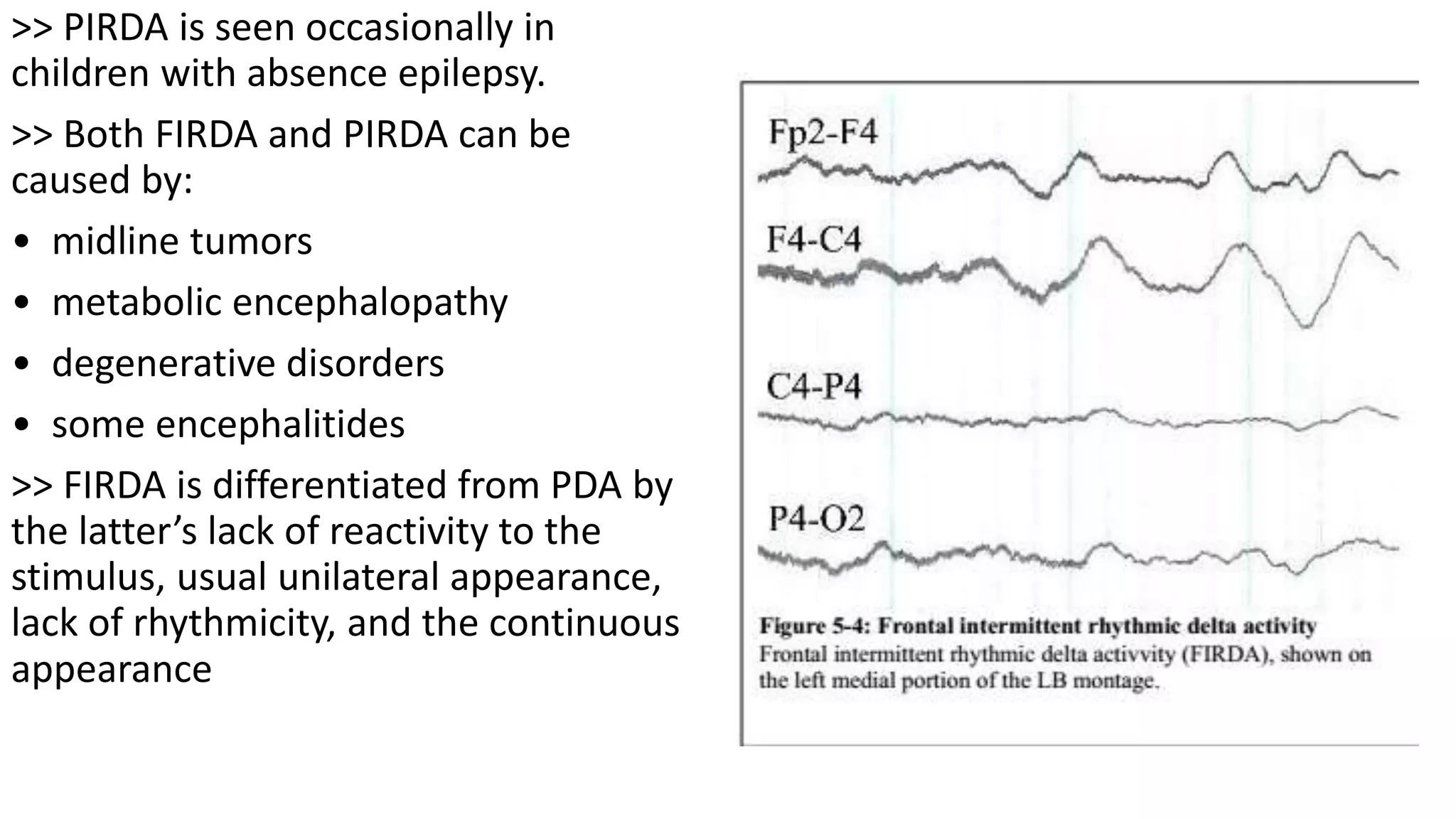 Abnormal eeg | PPTX