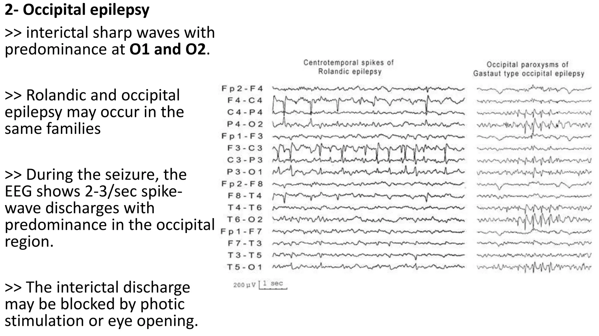 Abnormal eeg | PPTX