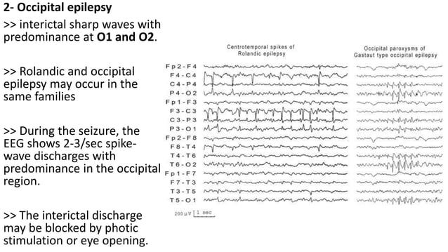Abnormal eeg | PPTX