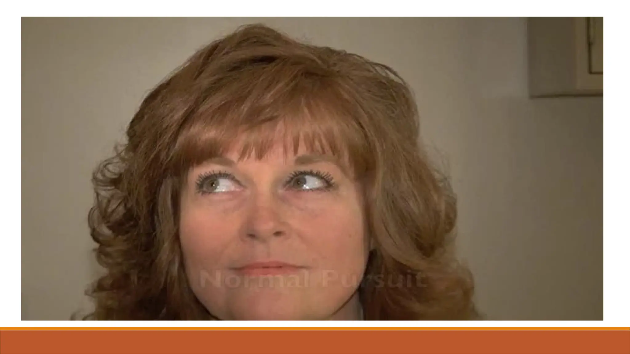 ABNORMAL EYE MOVEMENTS-SEEN IN OP PATIENTS.pptx