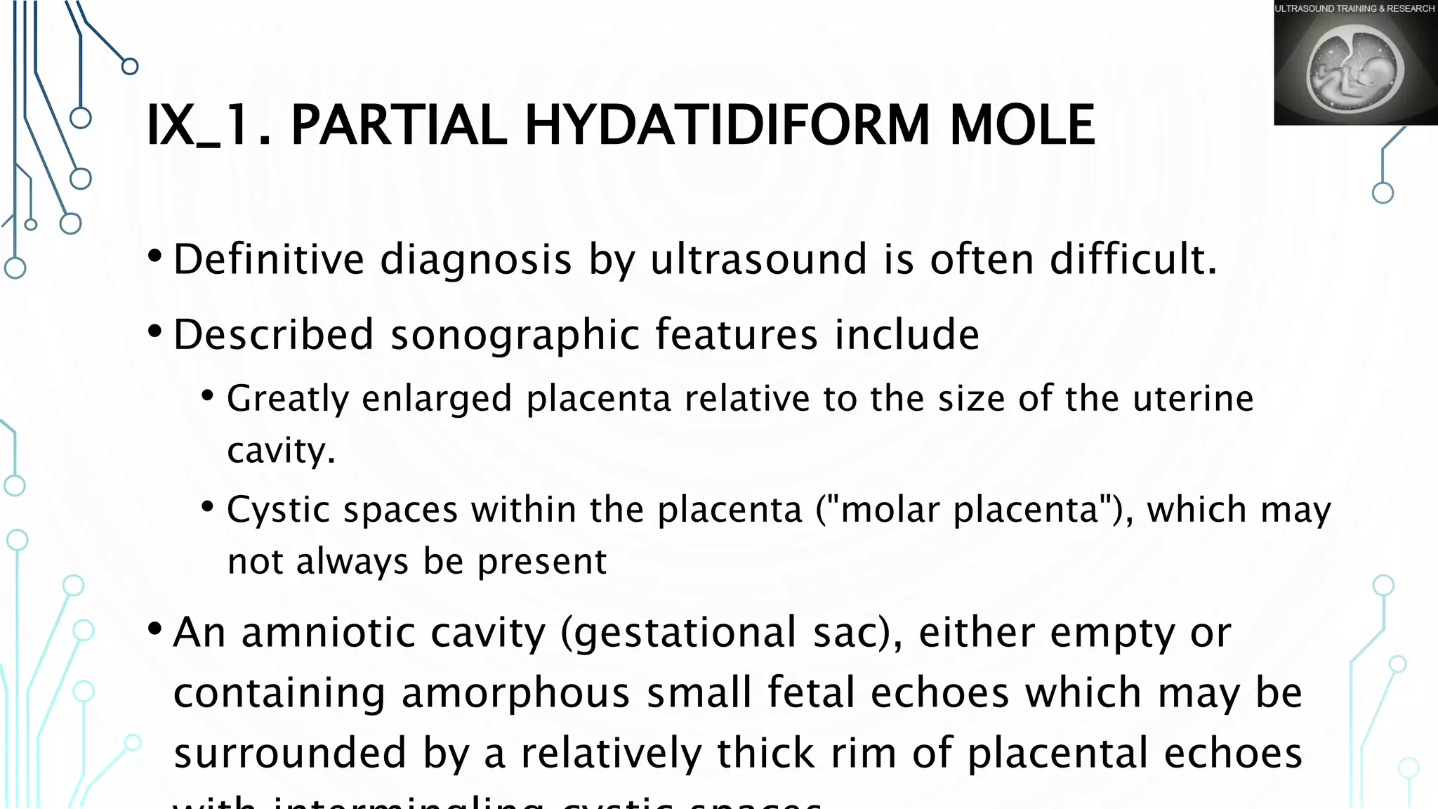 Abnormal first trimester scan | PPTX