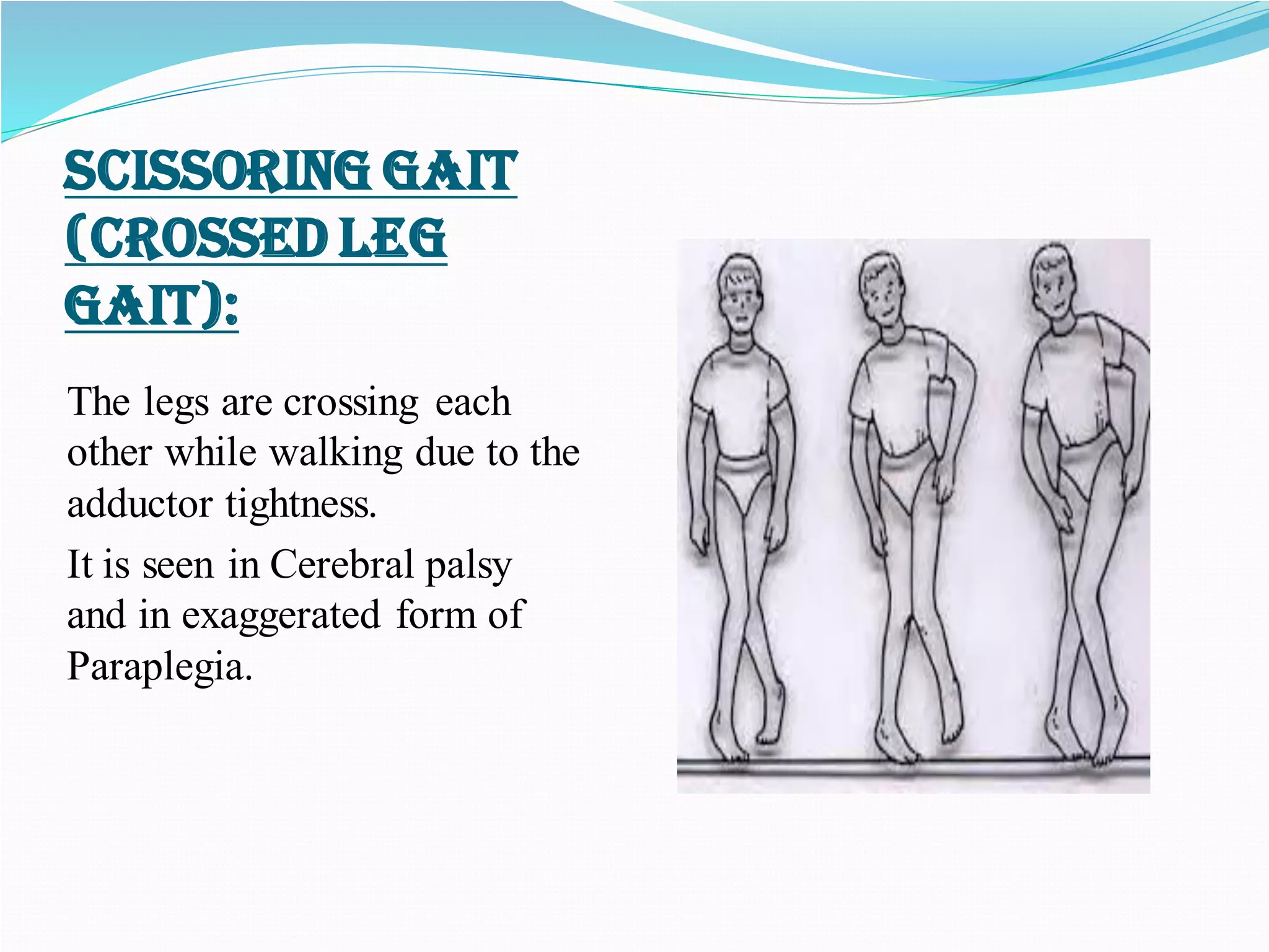 Abnormal gait by SURYA LIKHITA-VAPMS COLLEGE OF PHYSIOTHERAPY | PDF