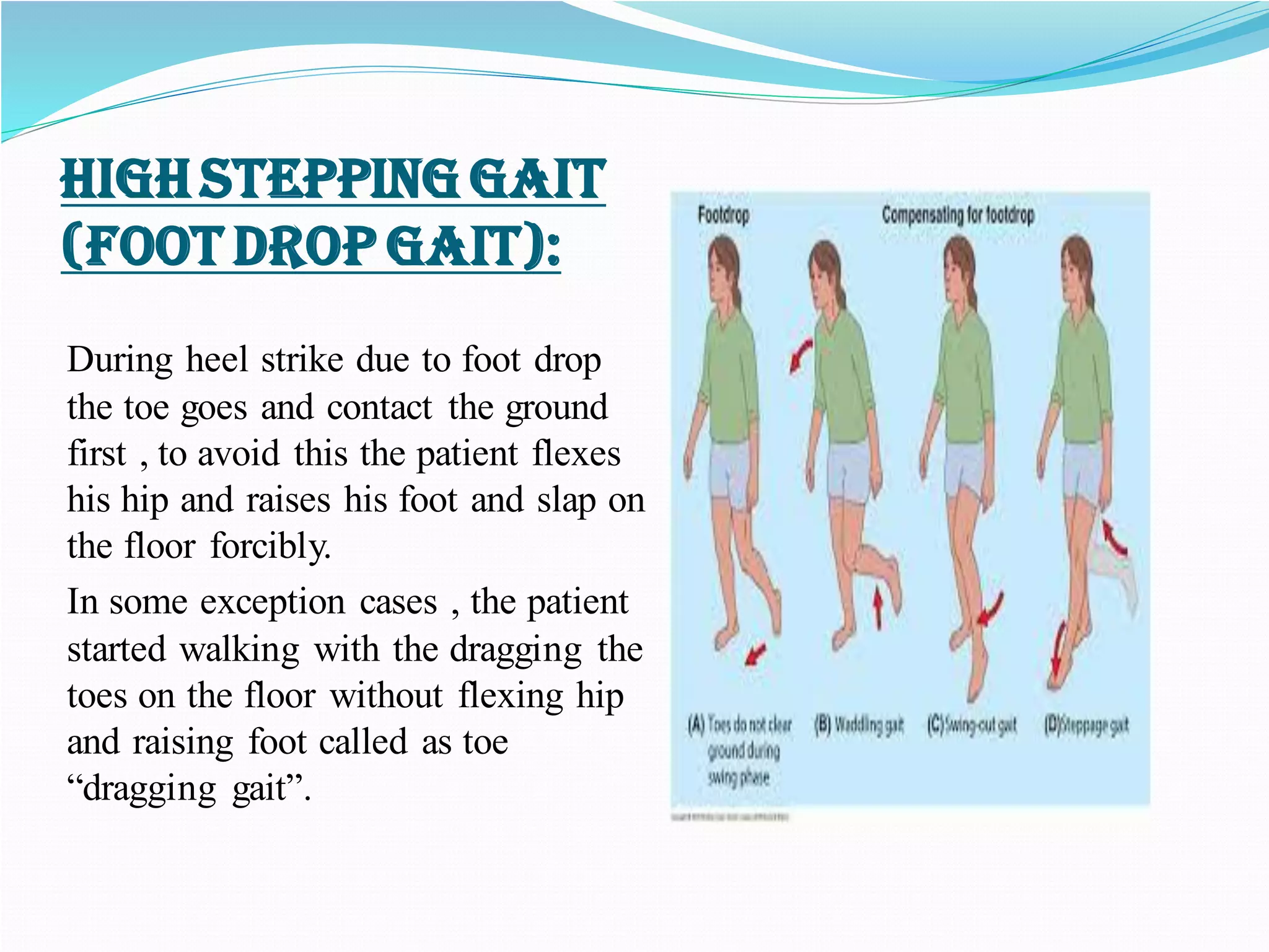 Abnormal gait by SURYA LIKHITA-VAPMS COLLEGE OF PHYSIOTHERAPY | PDF