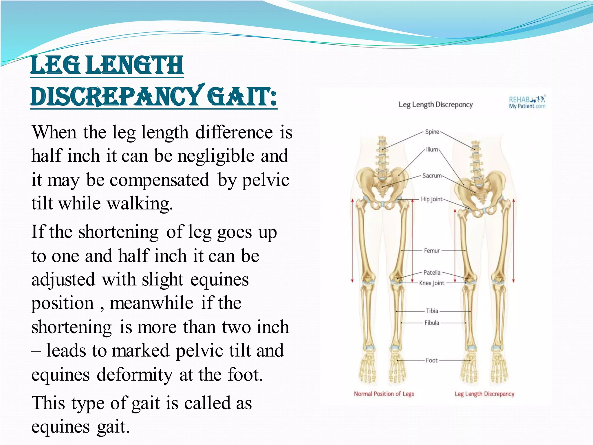 Abnormal gait by SURYA LIKHITA-VAPMS COLLEGE OF PHYSIOTHERAPY | PDF