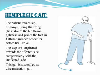 Abnormal gait by SURYA LIKHITA-VAPMS COLLEGE OF PHYSIOTHERAPY | PDF